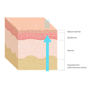 Severe Dry Skin Symptoms & Dermatologist Treatment Tips