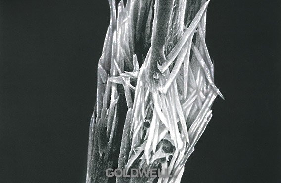 Damaged Human Hair Under Microscope