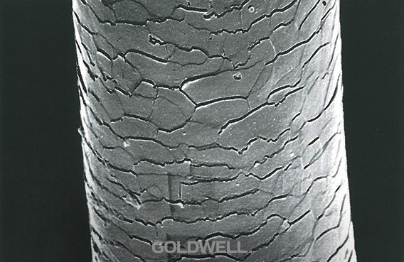 Damaged Human Hair Under Microscope